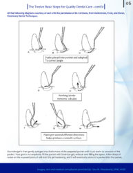 The 12-Step Cleaning Procedure - Dentalaire Products