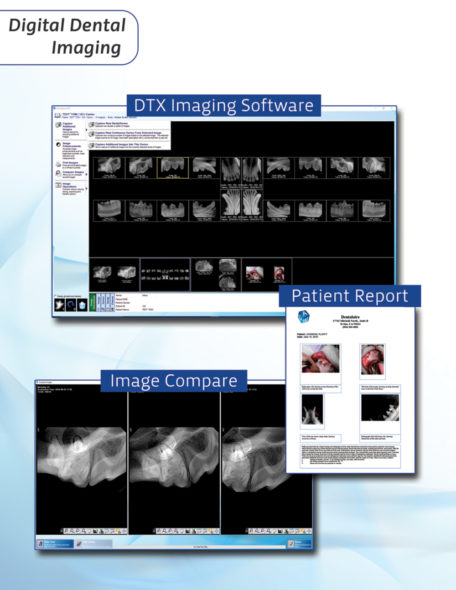 DTX Digital Dental Imaging System | Dentalaire Products
